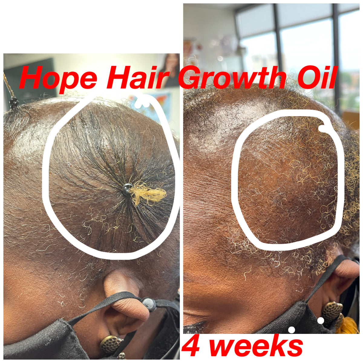 Hope Hair Growth Oil Serum – The TamaraJ